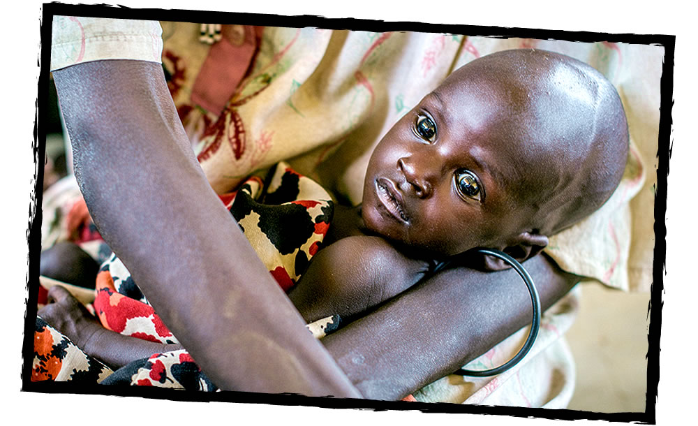 2017 Famine 30：Food for every Child